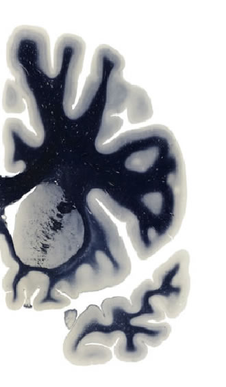 The Human Brain · Atlas of the Human Brain · Virtual Microscopy