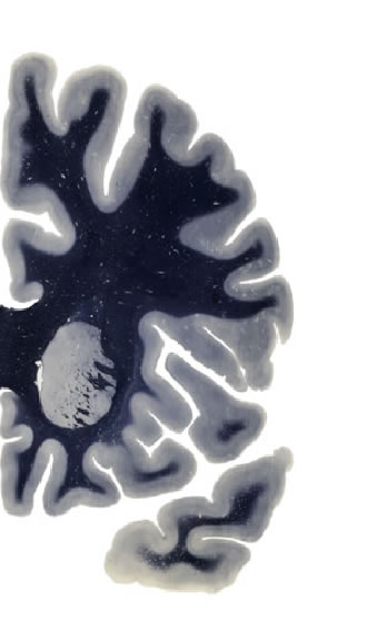 The Human Brain · Atlas of the Human Brain · Virtual Microscopy