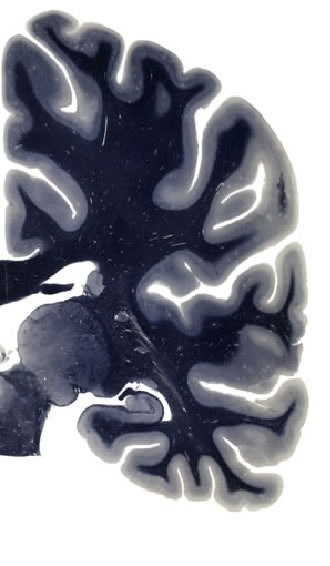 The Human Brain · Atlas of the Human Brain · Virtual Microscopy