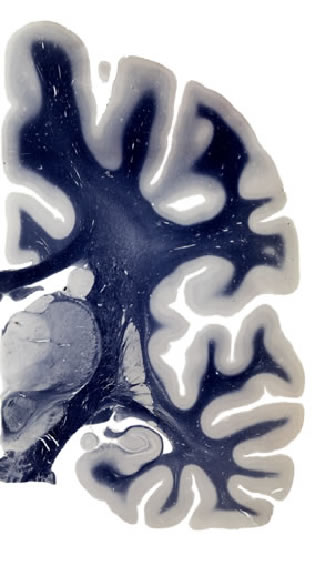 The Human Brain · Atlas of the Human Brain · Virtual Microscopy