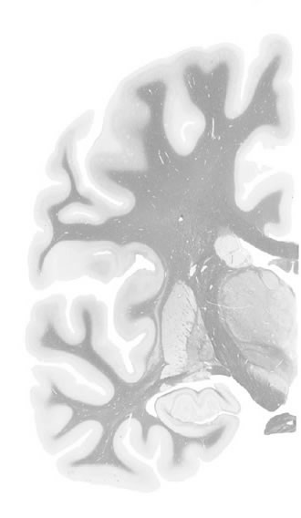 The Human Brain · Atlas of the Human Brain · Virtual Microscopy