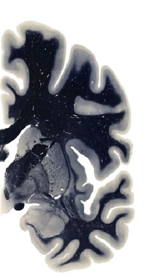 The Human Brain · Atlas of the Human Brain · Virtual Microscopy
