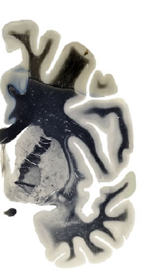 The Human Brain · Atlas of the Human Brain · Virtual Microscopy