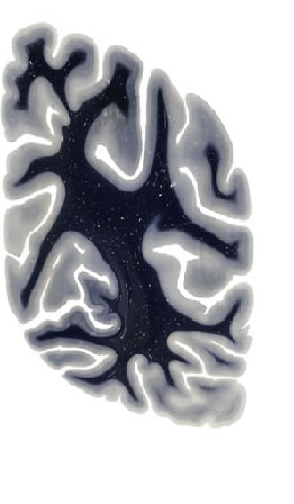 The Human Brain · Atlas of the Human Brain · Virtual Microscopy