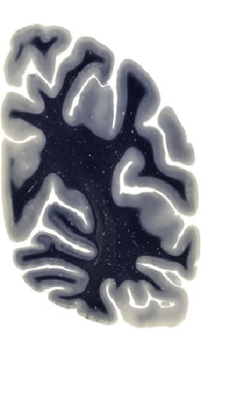 The Human Brain · Atlas of the Human Brain · Virtual Microscopy