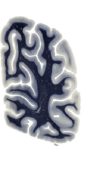 The Human Brain · Atlas of the Human Brain · Virtual Microscopy