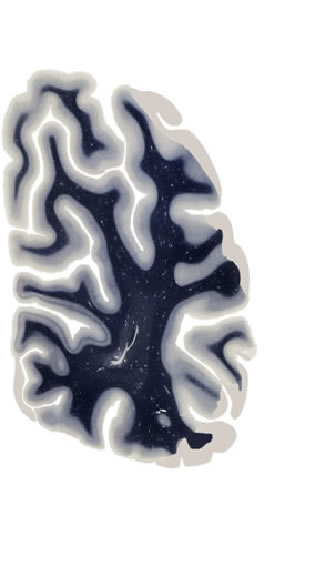 The Human Brain · Atlas of the Human Brain · Virtual Microscopy