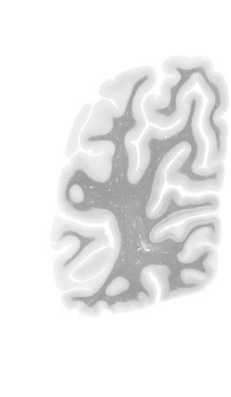 The Human Brain · Atlas of the Human Brain · Virtual Microscopy