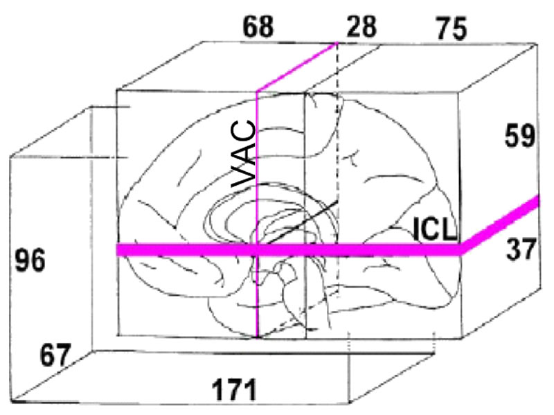 The Human Brain · Atlas of the Human Brain · The 3D space (Reference ...
